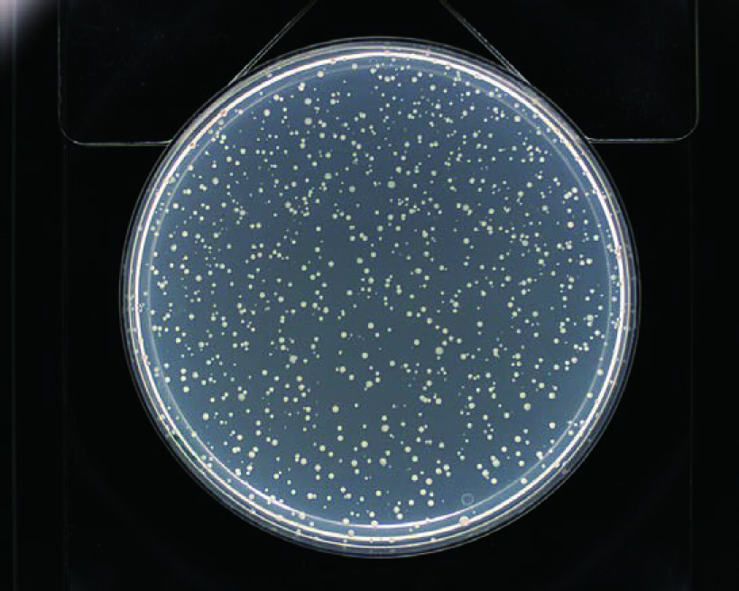 Automatic Colony Counter